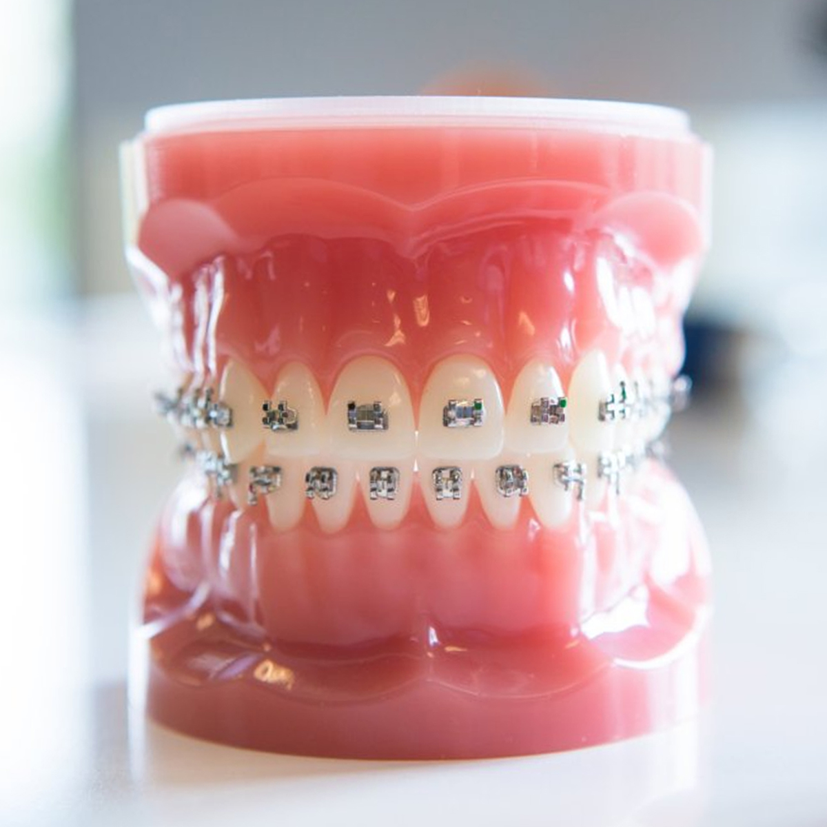 Fixed Braces | Orthodontic Treatments | Belwell Dental Birmingham