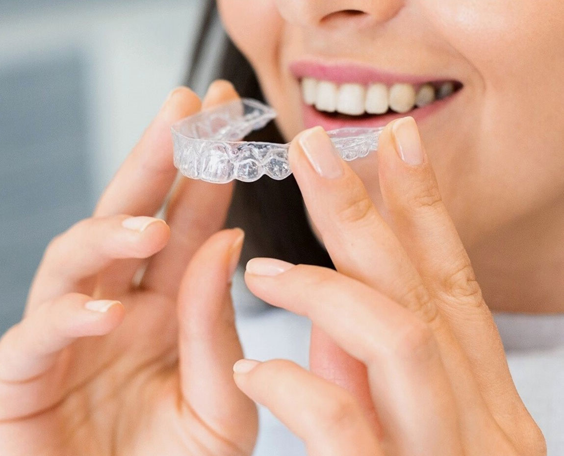 Clear Correct Braces | Affordable Invisible Braces | Birmingham