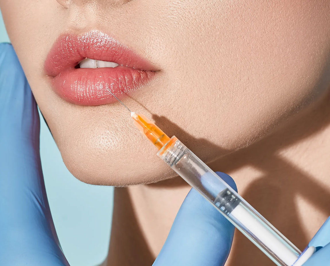 Lip Filler Treatment Four Oaks, Sutton Coldfield | Lip Enhancement