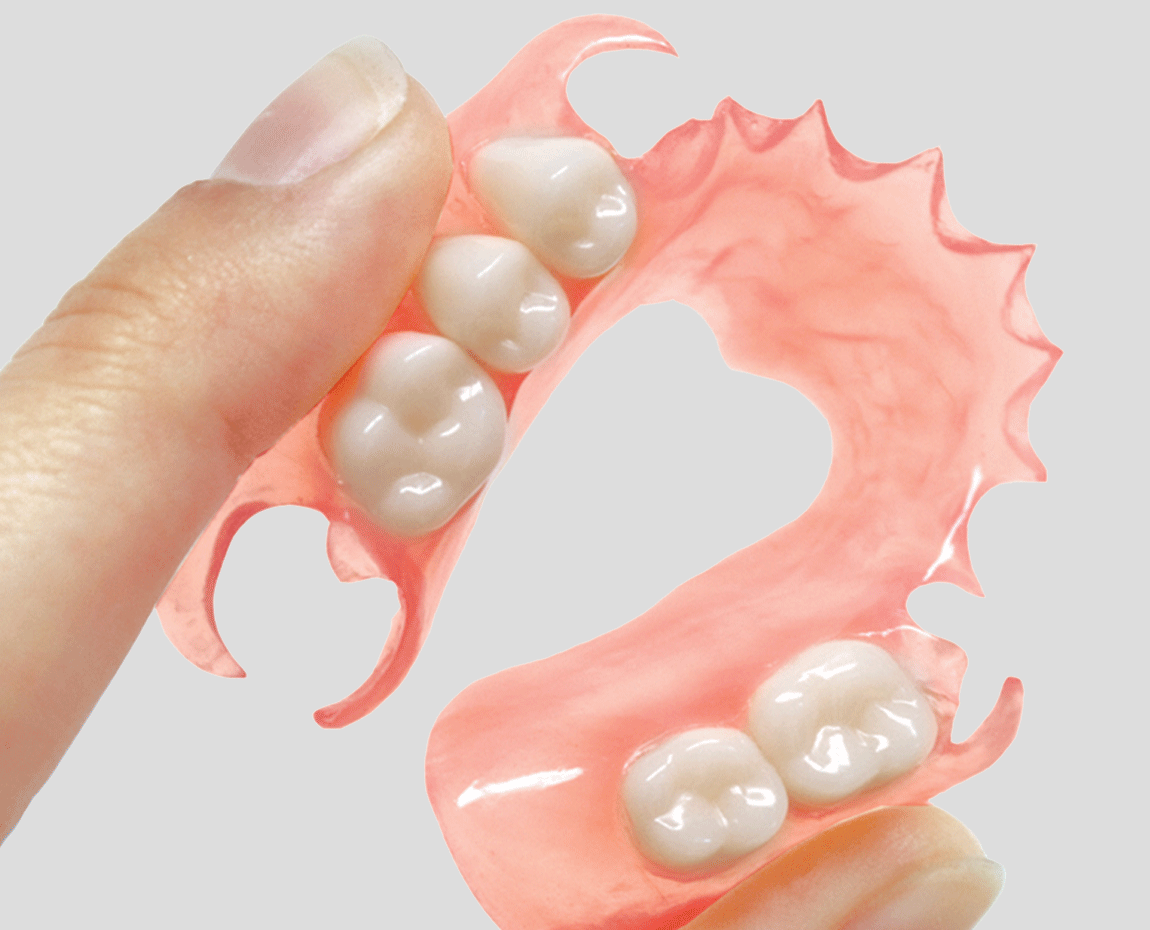 Dentures - Partial & Flexible Dentures - Belwell Dental